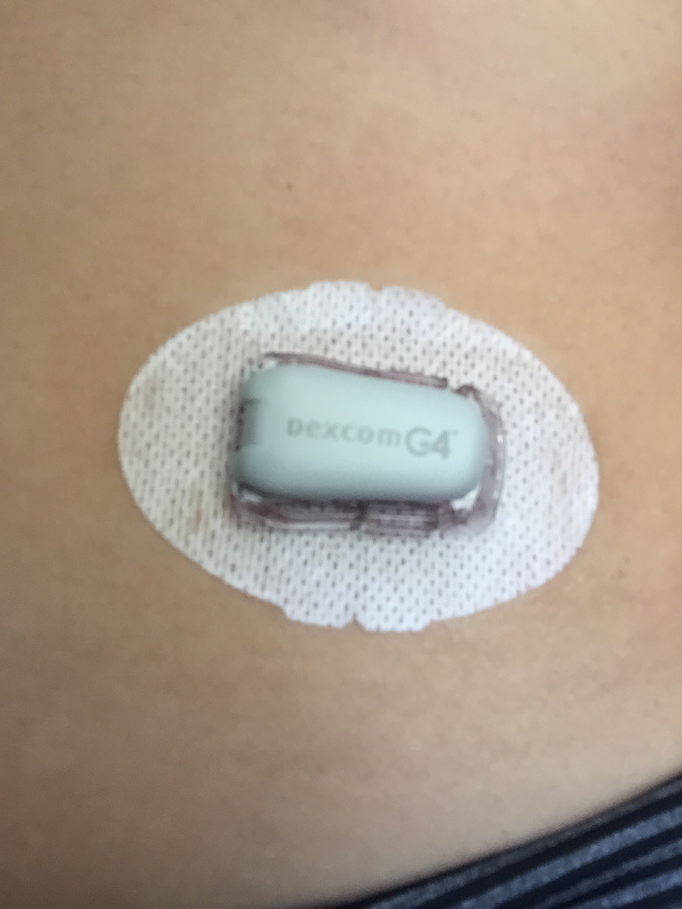 Dexcom – Continuous Glucose Monitor Trial | Nourishing Zen